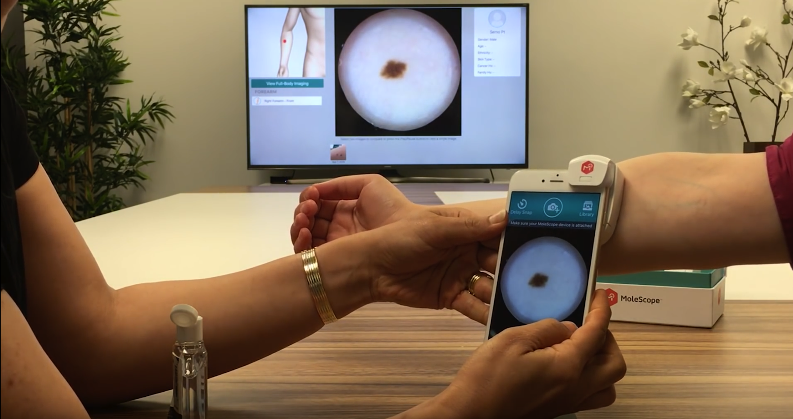 Digital Dermoscopy: Top 4 Enhancements for your Device